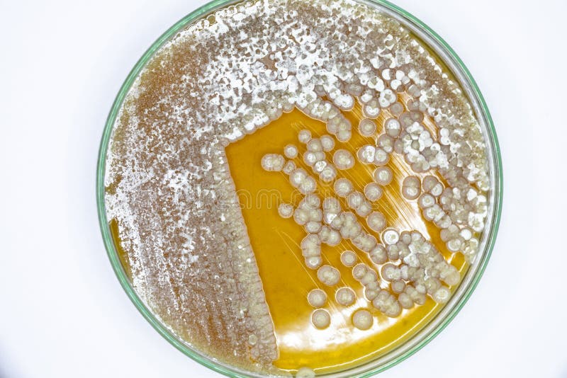 Study Colony Characteristic of Actinomyces, Bacteria, Yeast and Mold on ...