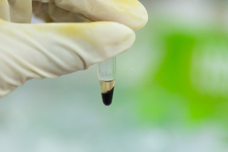 Study of Fish Blood Composition. Stock Image - Image of laboratory ...