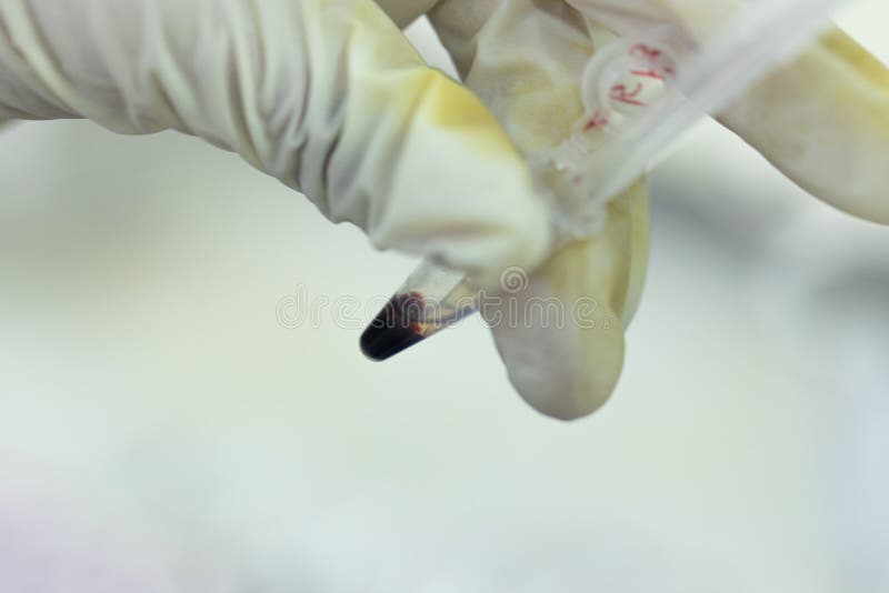 Study of Fish Blood Composition. Stock Image - Image of blood ...