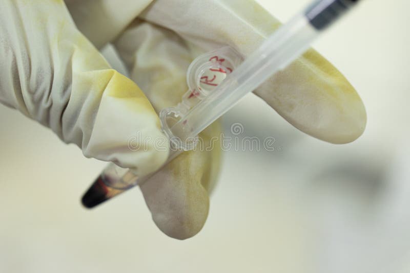 Study of Fish Blood Composition. Stock Image - Image of biochemistry ...