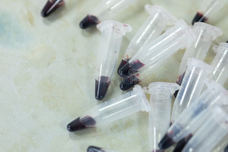 Study of Fish Blood Composition. Stock Image - Image of micropipette ...