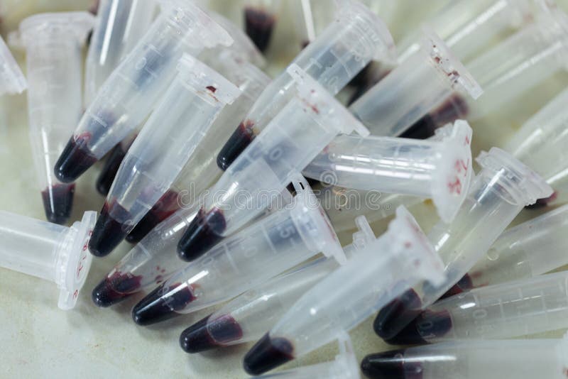 Study of Fish Blood Composition. Stock Photo - Image of chemical ...