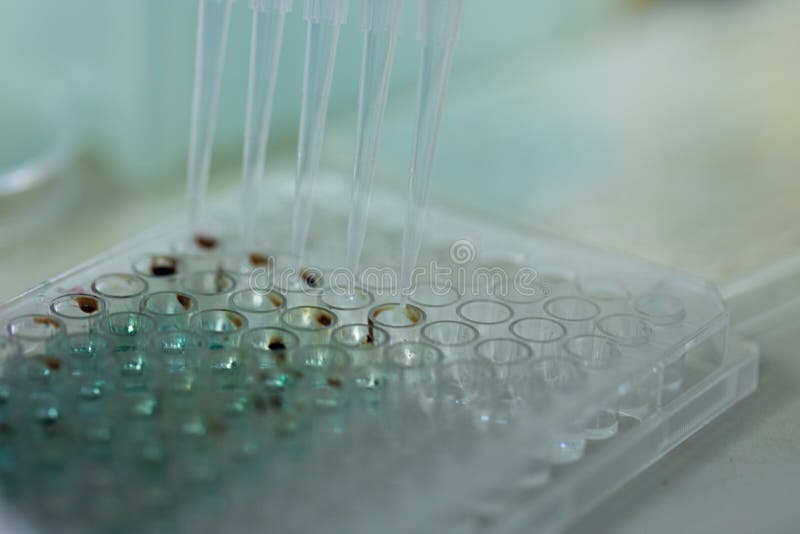 Study of Fish Blood Composition. Stock Image - Image of immunoglobulin ...