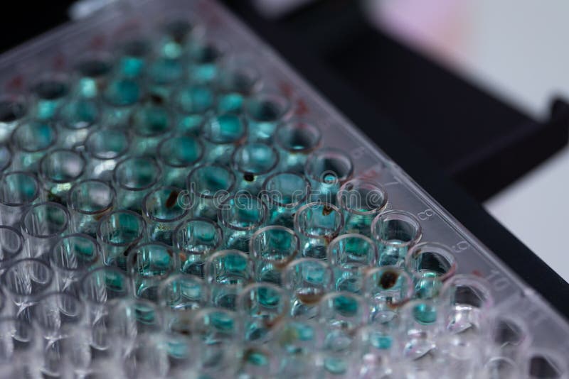 Fish Blood Cells at Microscope Stock Image - Image of blood, look ...