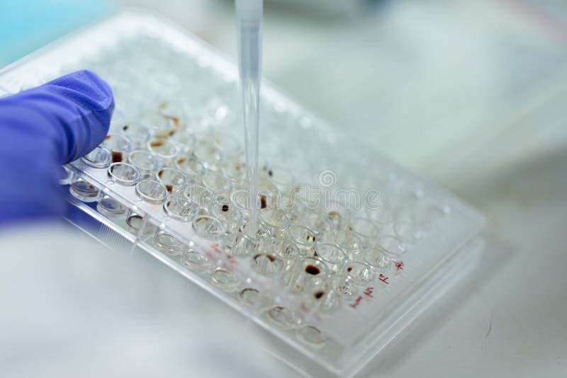 Study Of Fish Blood Composition. Stock Photo - Image of micropipette ...