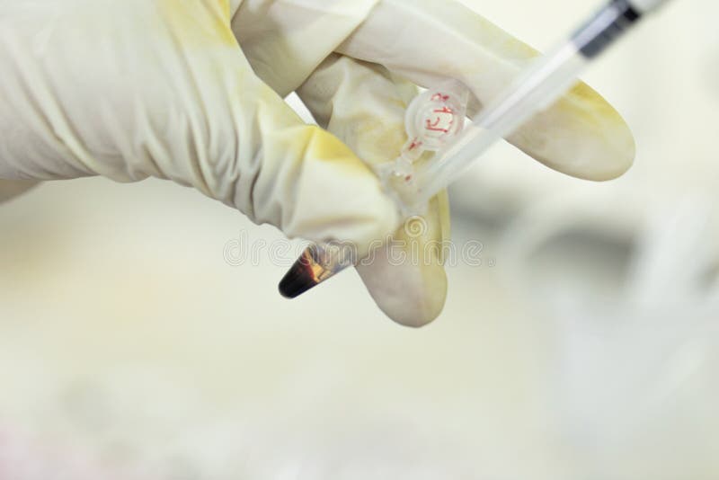 Study of Fish Blood Composition. Stock Image - Image of analysis ...