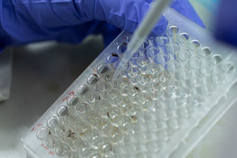 Study of Fish Blood Composition. Stock Photo - Image of analysis ...