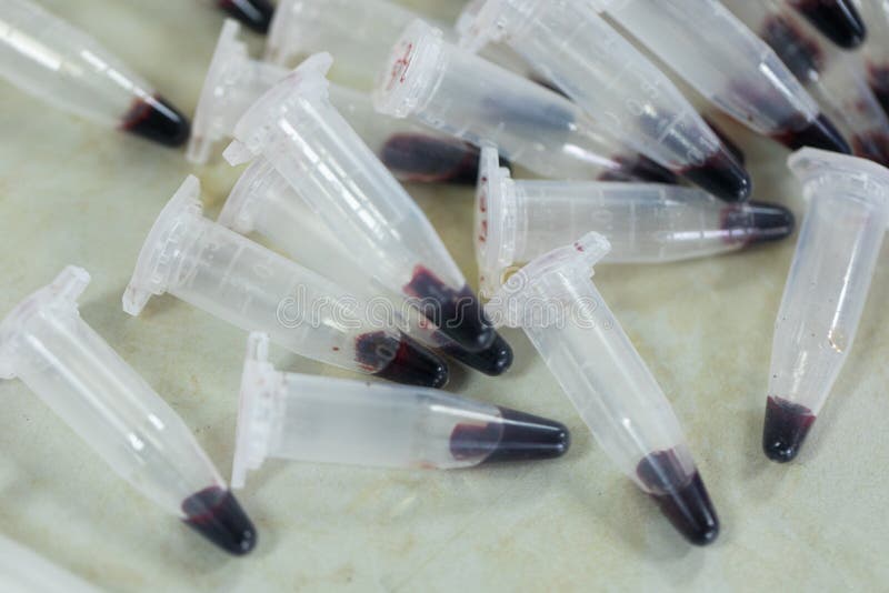 Study of Fish Blood Composition. Stock Photo - Image of chemical ...