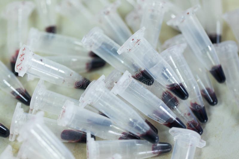 Study of Fish Blood Composition. Stock Image - Image of measurement ...