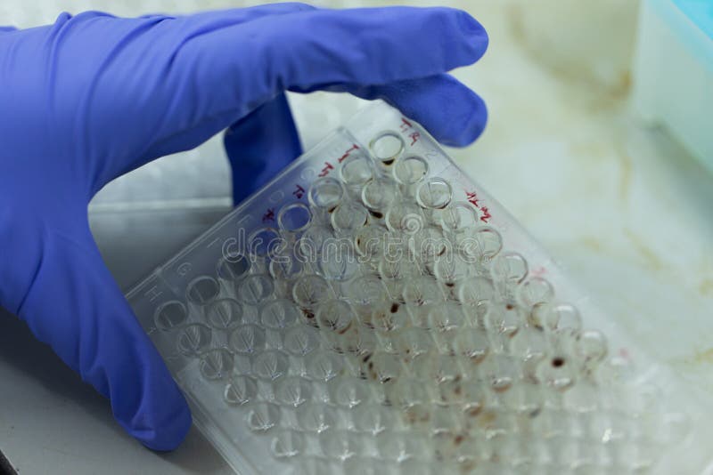 Study Of Fish Blood Composition. Stock Photo - Image of measurement ...