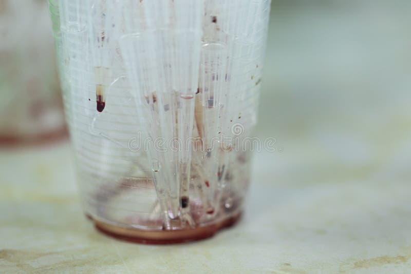 Study of Fish Blood Composition. Stock Image - Image of assay, elisa ...