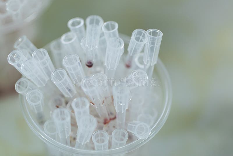 Study of Fish Blood Composition. Stock Photo - Image of analysis ...