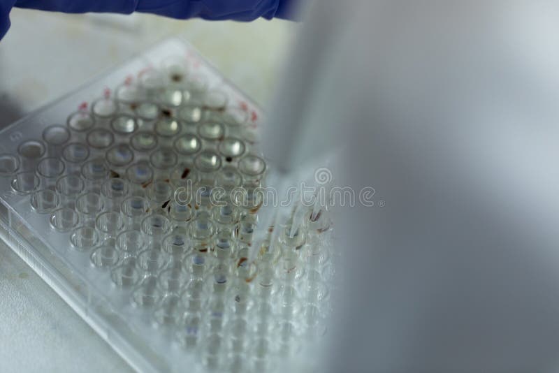 Study Of Fish Blood Composition. Stock Photo - Image of biology ...