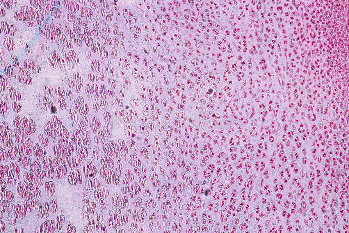 599 Human Bone Texture Stock Photos - Free & Royalty-Free Stock Photos ...