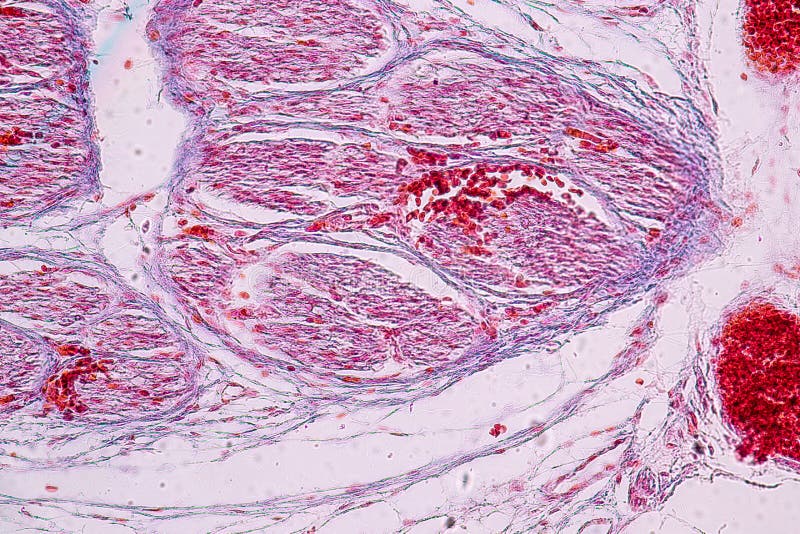 Study Histology Of Human, Tissue Bone Under The Microscopic. Stock ...