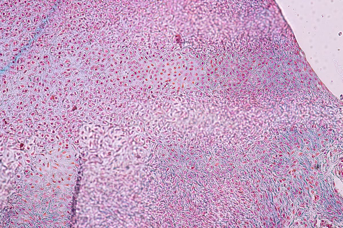 599 Human Bone Texture Stock Photos - Free & Royalty-Free Stock Photos ...