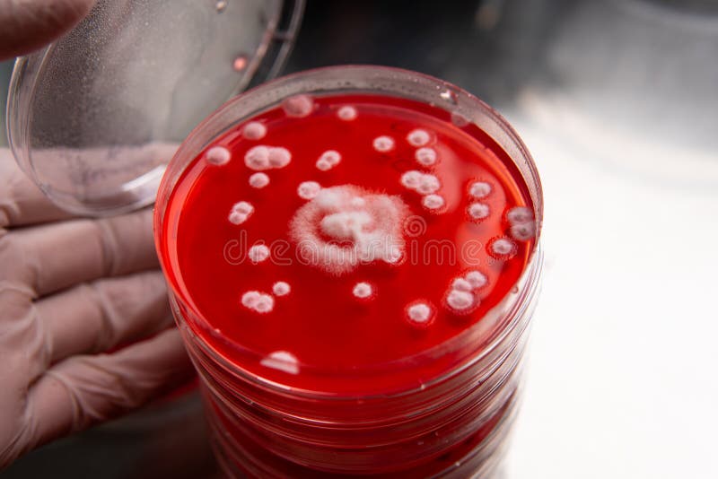 Study of Mold and Bacteria in a Petri Dish with Red Agar. Mold Spores ...