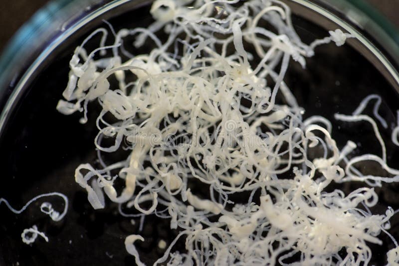 The Study Parasite or Worms is a Freshwater Fish Parasite in Laboratory ...