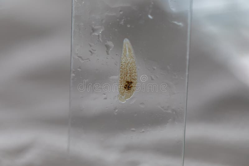 The Study Parasite or Worms is a Freshwater Fish Parasite in Laboratory ...