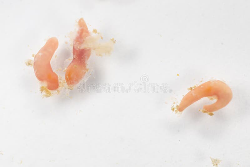 Parasitic Helminths (Trematodes) of Marine Fishes Under a Microscope ...