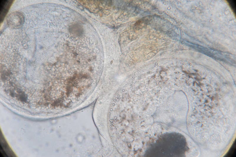 Parasitic Helminths (Trematodes) of Marine Fishes Under a Microscope ...