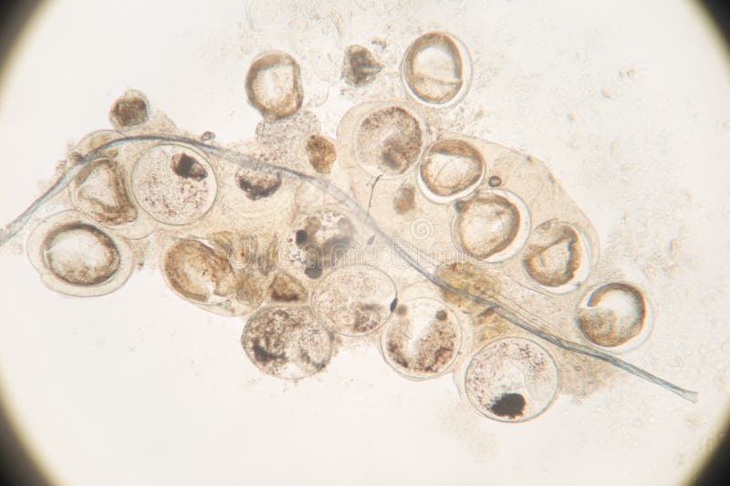 Parasitic Helminths (Trematodes) of Marine Fishes Under a Microscope ...