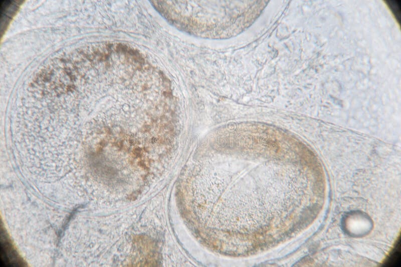 Parasitic Helminths (Trematodes) of Marine Fishes Under a Microscope ...