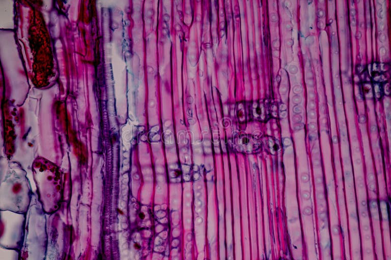 Plant Tissues Under the Microscope in the Laboratory. Stock Photo ...