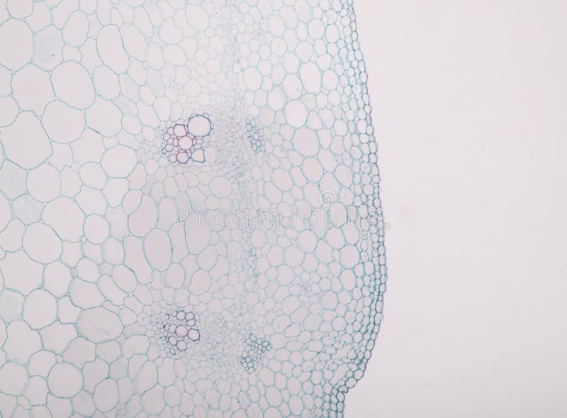 Sclerenchyma Tissue Under Microscope