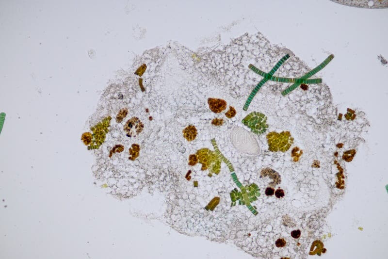 Protozoa and Plant Cells Under the Microscope for Education. Stock ...
