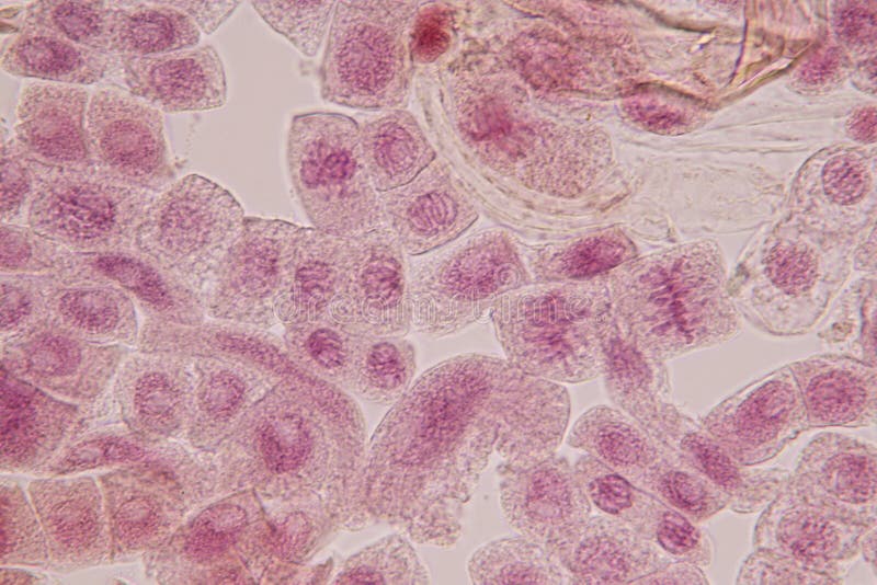 Root Tip of Onion and Mitosis Cell in the Root Tip of Onion Under a ...