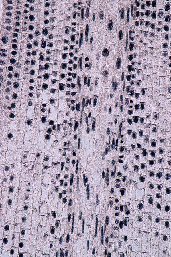 Root Tip of Onion and Mitosis Cell in the Root Tip of Onion Under a ...