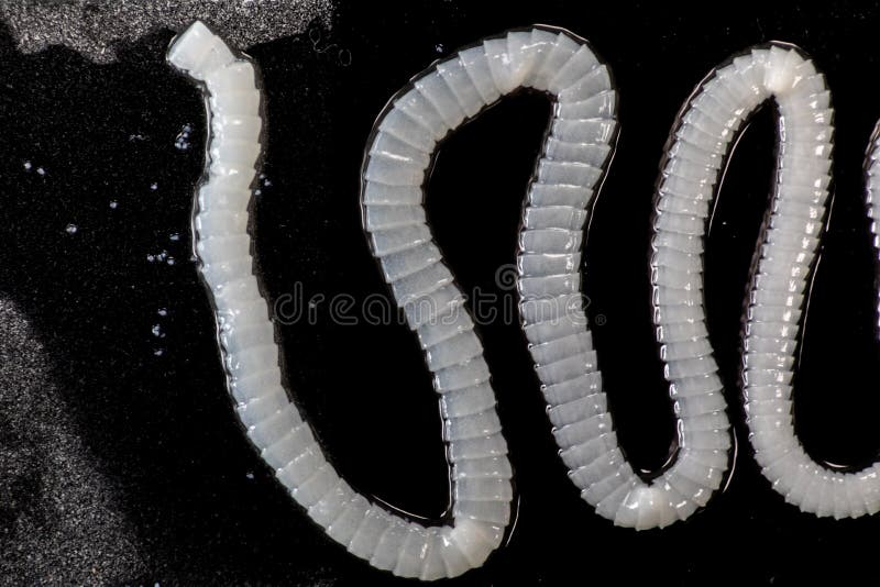 The Study of Tapeworm Infection is Caused by Ingesting Food or Water ...