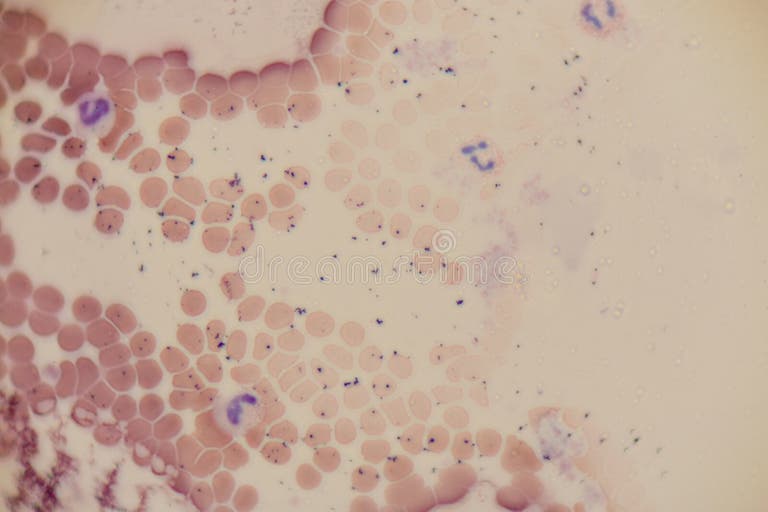 Blood Platelets Under Microscope Stock Photos - Free & Royalty-Free ...