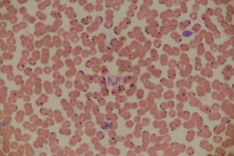 Study of White Blood Cells are the Cells of the Immune System Under the ...