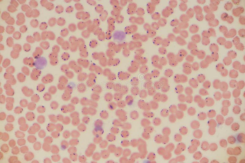 Study of White Blood Cells are the Cells of the Immune System Under the ...