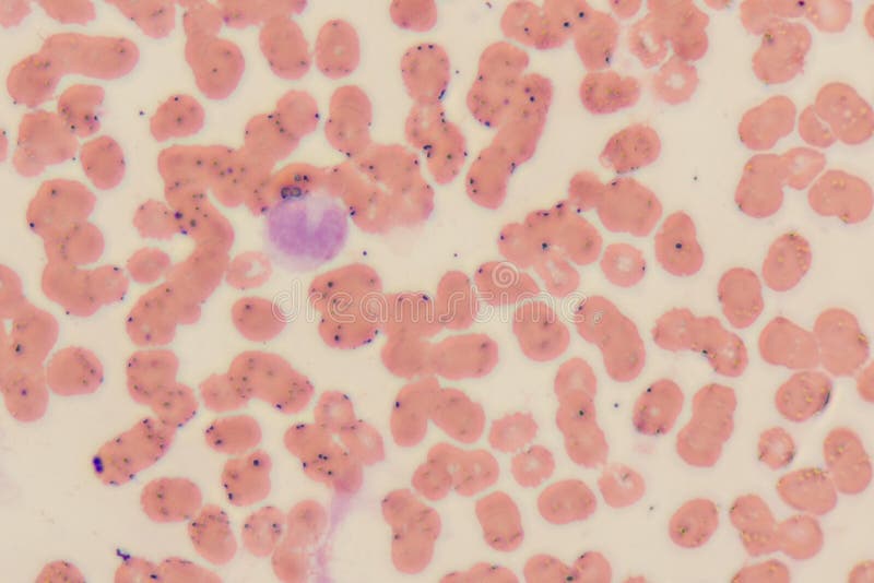 Study of White Blood Cells are the Cells of the Immune System Under the ...