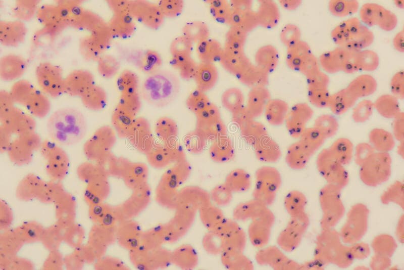 Study of White Blood Cells are the Cells of the Immune System Under the ...