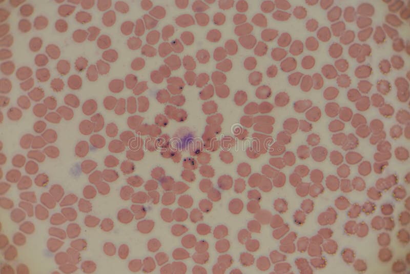 Study of White Blood Cells are the Cells of the Immune System Under the ...