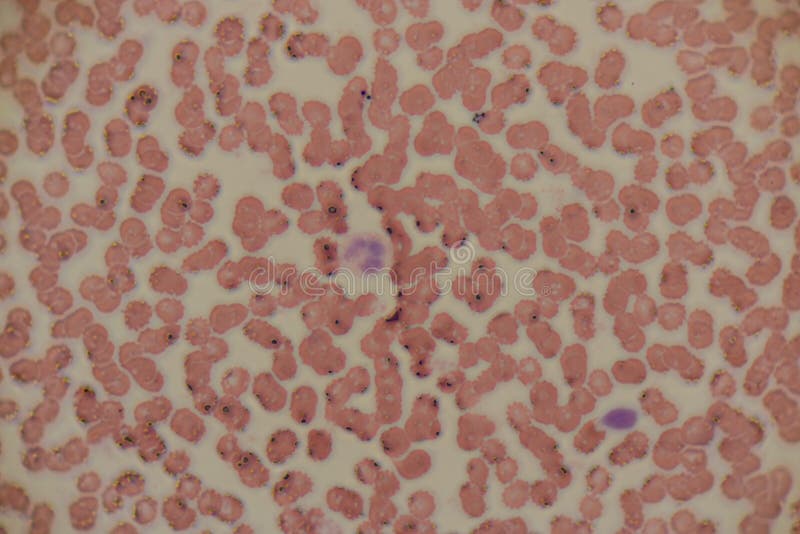 White Blood Cells Under Microscope Labeled