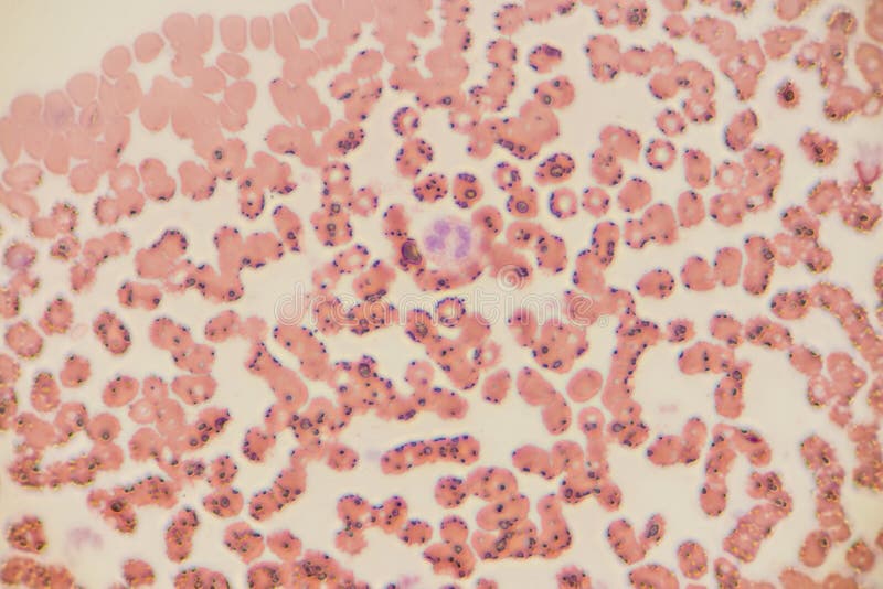 Study of White Blood Cells are the Cells of the Immune System Under the ...