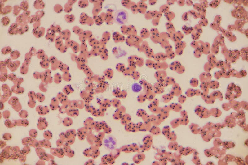 White Blood Cells are the Cells of the Immune System Under the ...