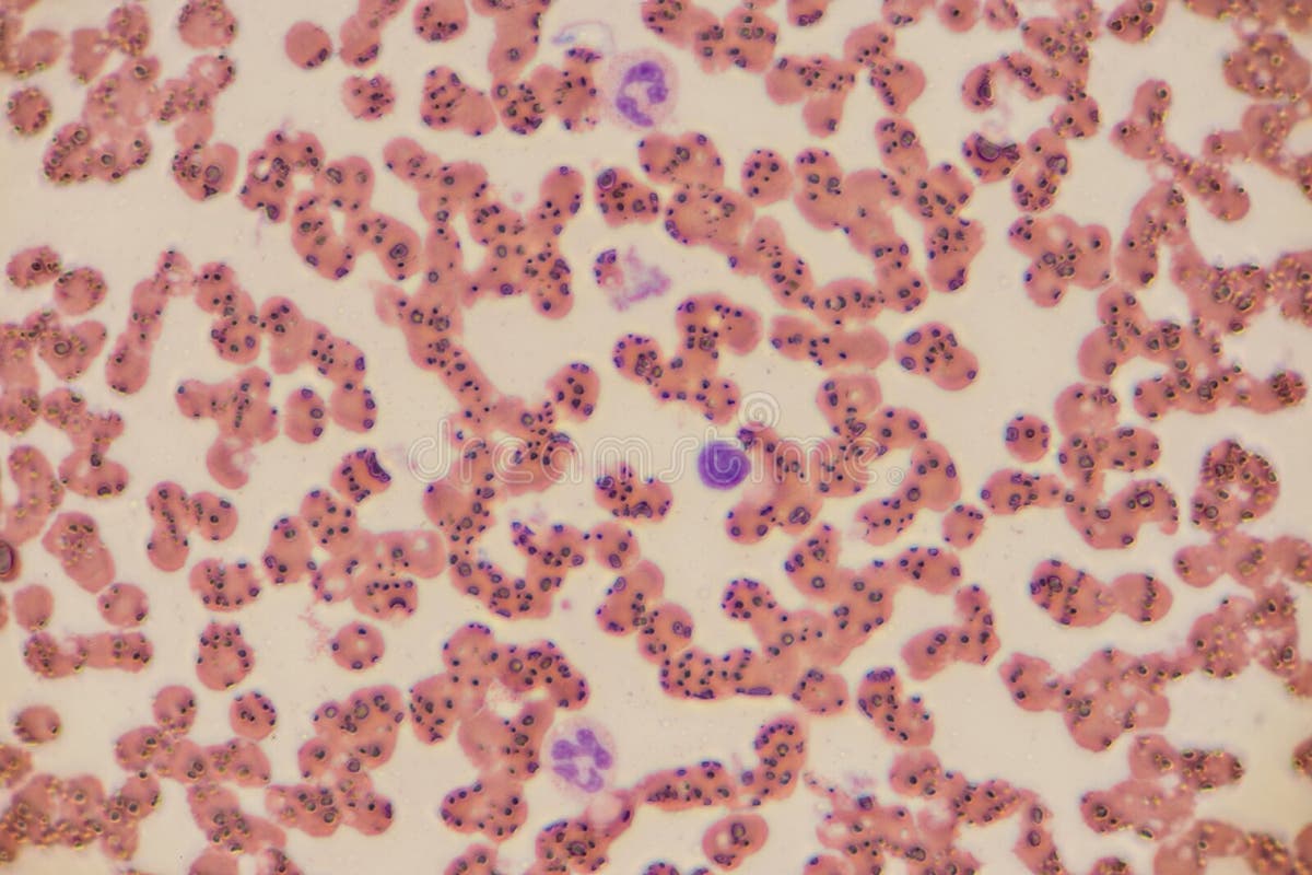 Blood Platelets Under Microscope Stock Photos - Free & Royalty-Free ...