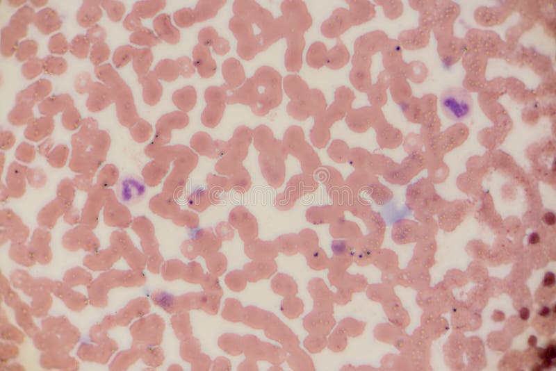 Study of White Blood Cells are the Cells of the Immune System Under the ...