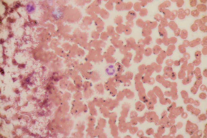 Study of White Blood Cells are the Cells of the Immune System Under the ...