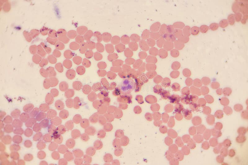 Study Of White Blood Cells Are The Cells Of The Immune System Under The ...