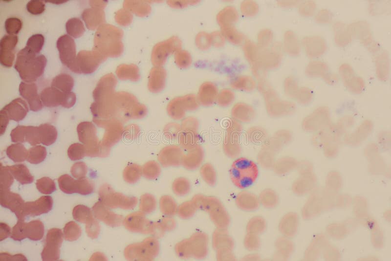 Study of White Blood Cells are the Cells of the Immune System Under the ...