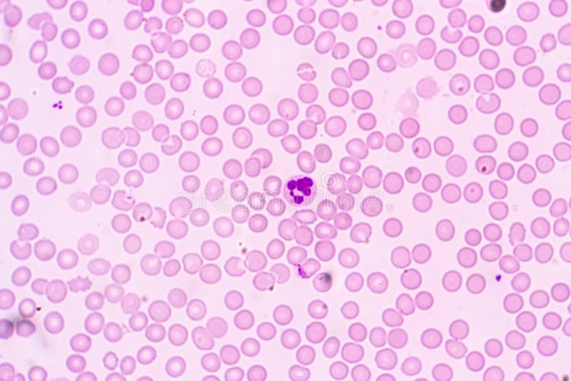 White Blood Cells are the Cells of the Immune System Under the ...