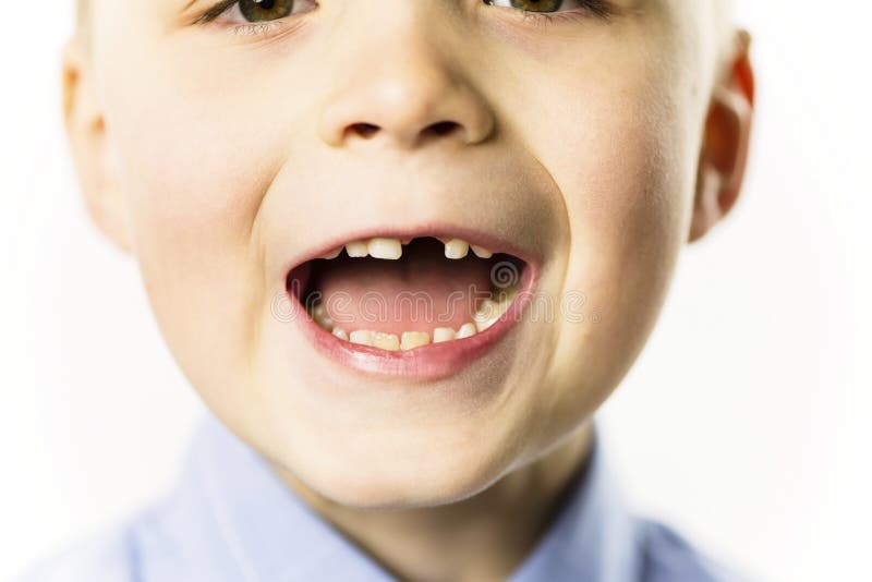 Stylish Boy without a Front Tooth is Smiling Stock Image - Image of ...