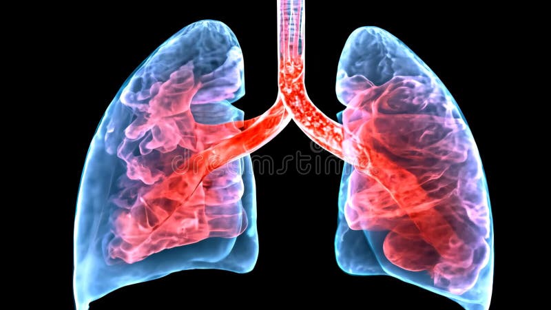 Stylized X-ray Image of Human Lungs, Highlighting the Bronchial Tree in ...